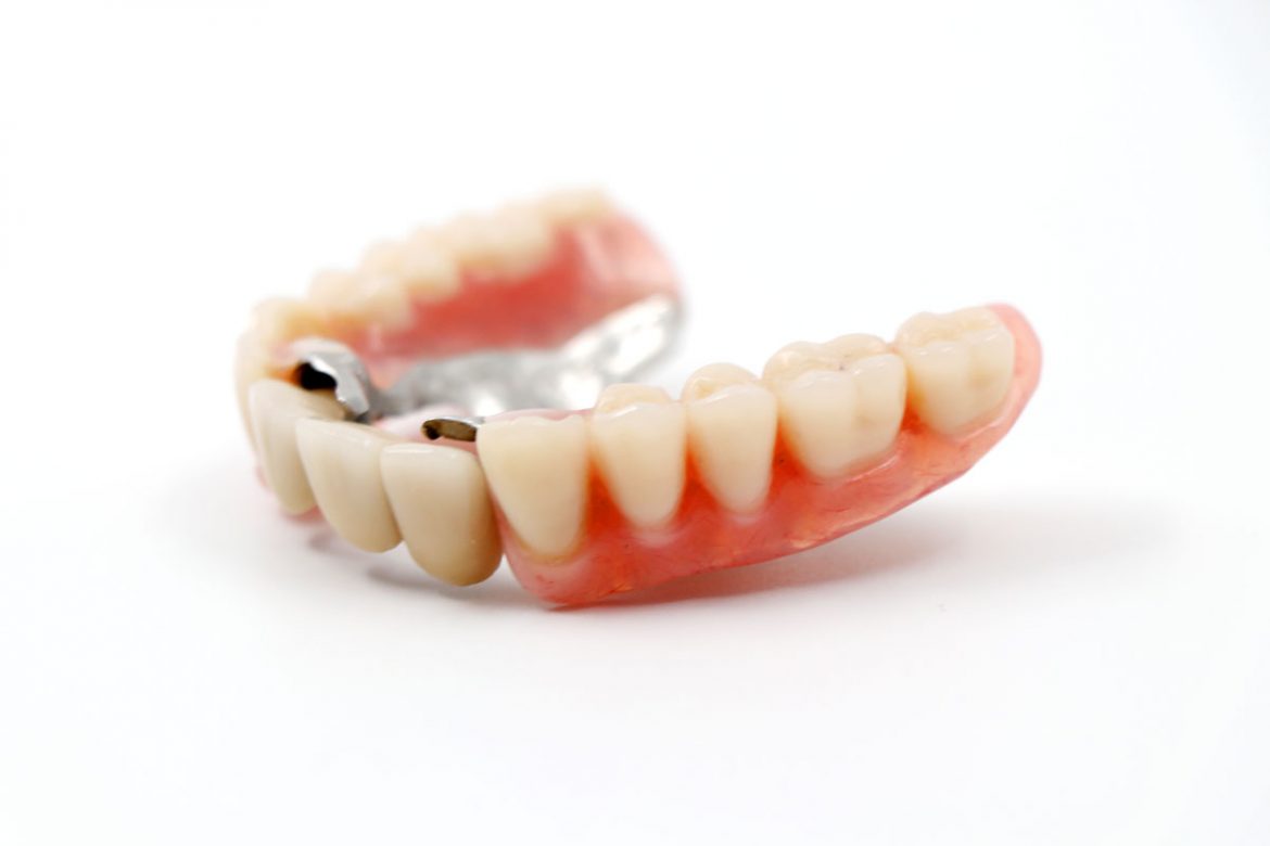 Totalne i parcijalne proteze - Stomatolog Jovšić